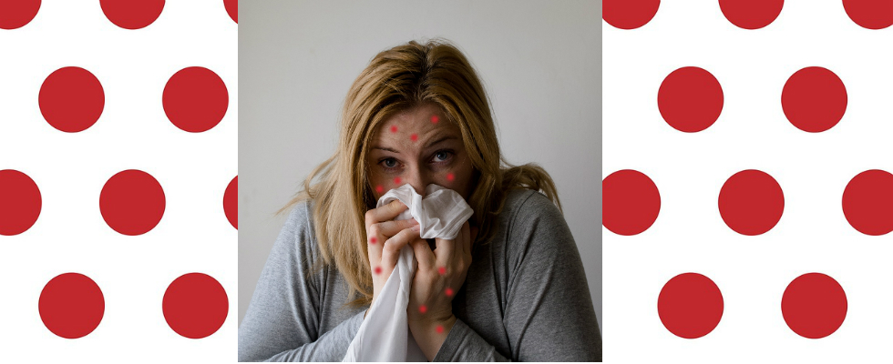 Hoe komt het dat volwassenen zo ziek worden van waterpokken? - Zin.nl